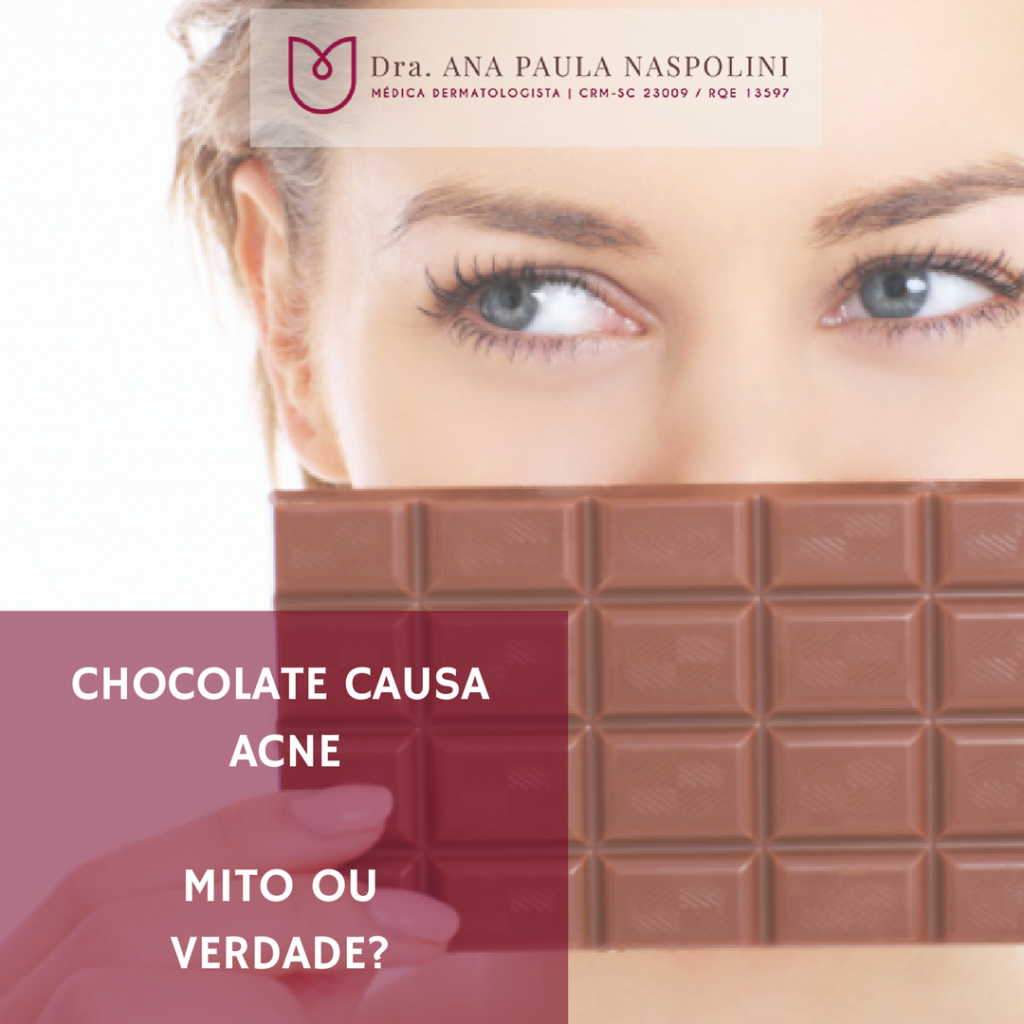 Chocolate causa Acne: Mito ou Verdade? – Dra. Ana Paula Naspolini ...